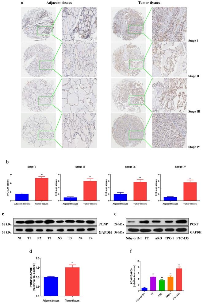 PCNP is a novel regulator of proliferation, migration, and invasion in ...