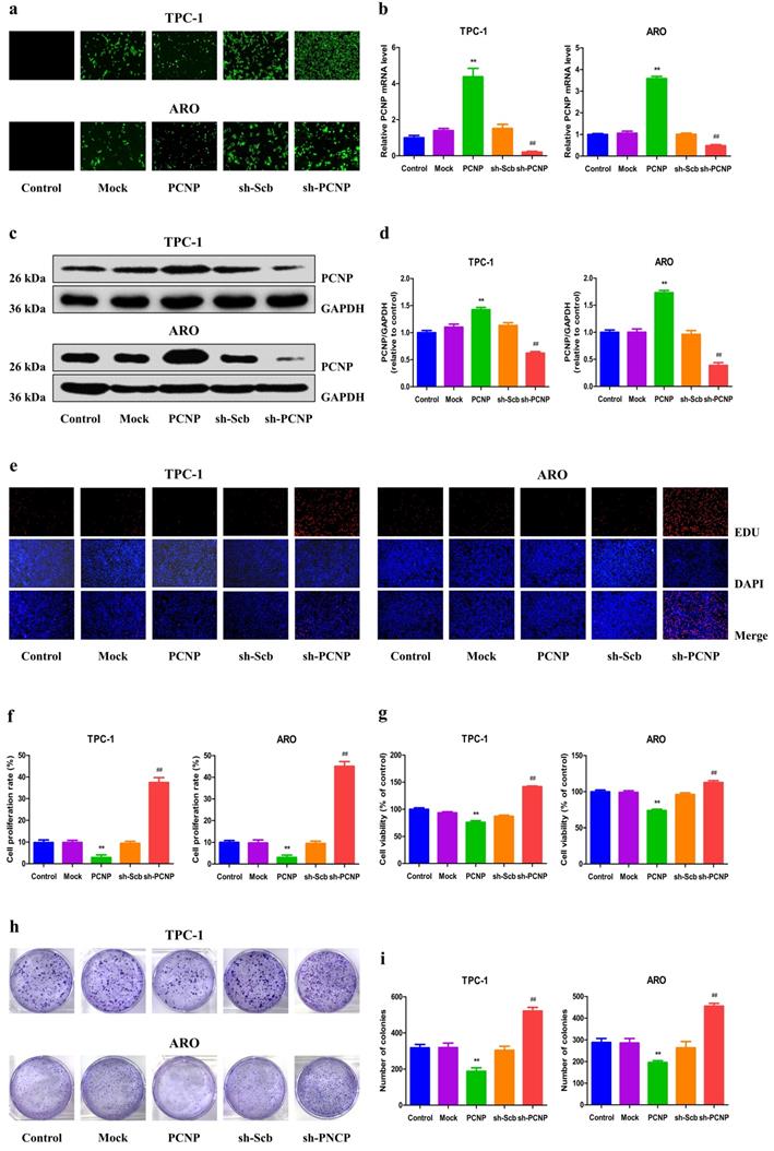 PCNP is a novel regulator of proliferation, migration, and invasion in ...
