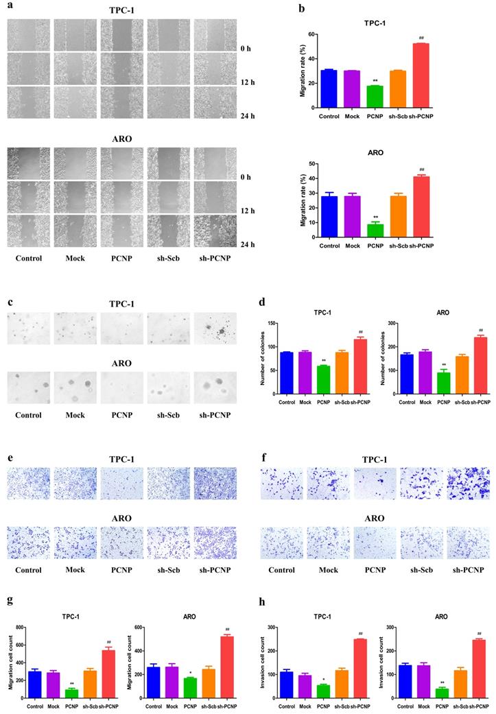 PCNP is a novel regulator of proliferation, migration, and invasion in ...