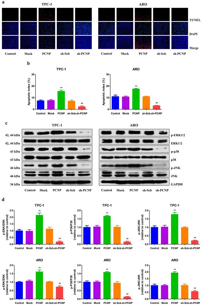 PCNP is a novel regulator of proliferation, migration, and invasion in ...
