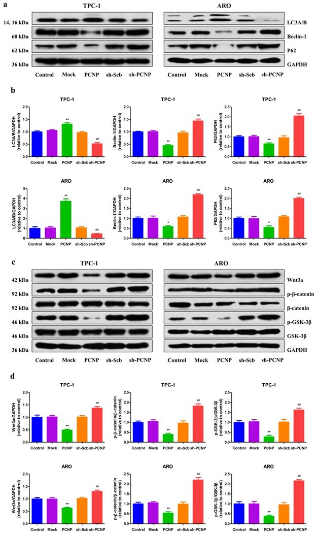 PCNP is a novel regulator of proliferation, migration, and invasion in ...