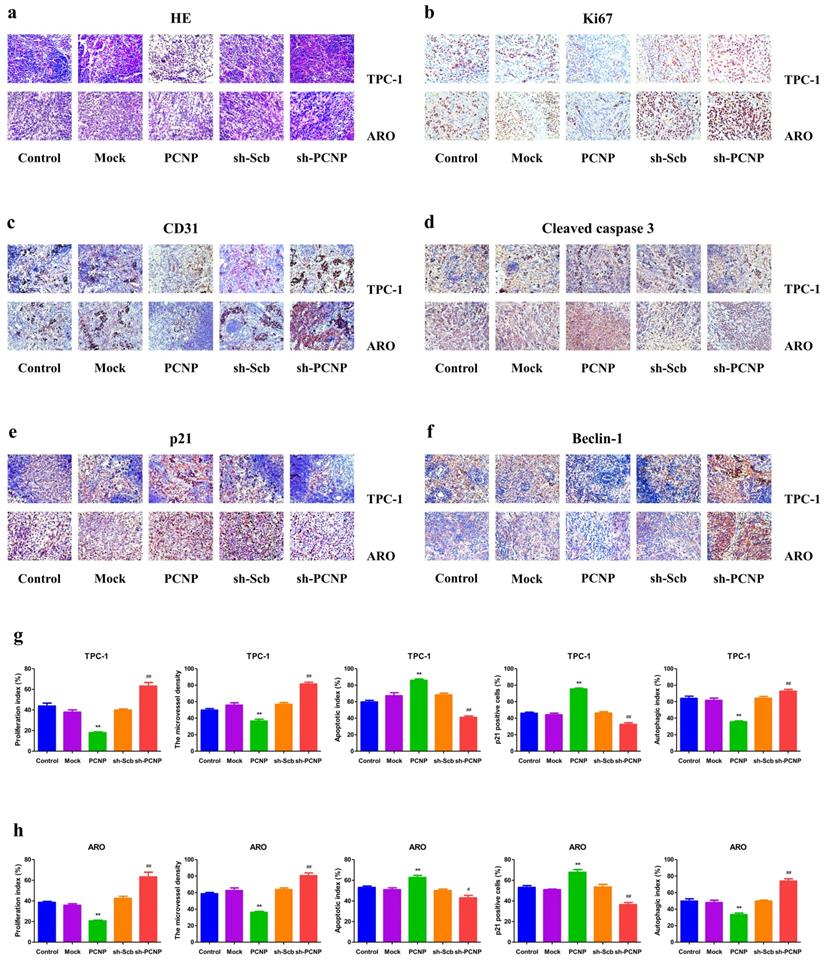 PCNP is a novel regulator of proliferation, migration, and invasion in ...