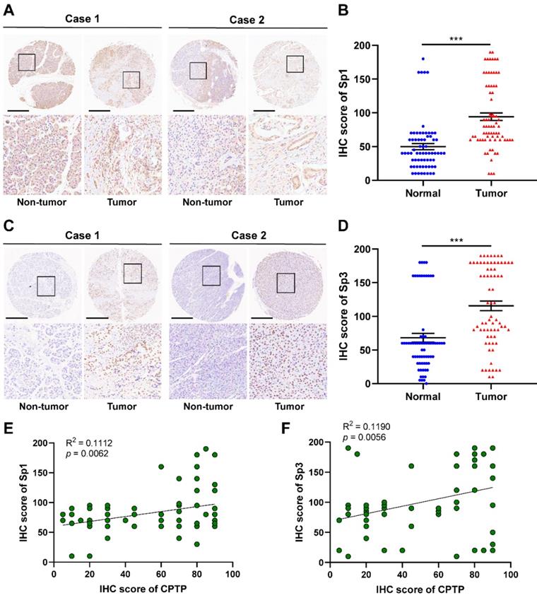 Human CPTP promotes growth and metastasis via sphingolipid metabolite ...
