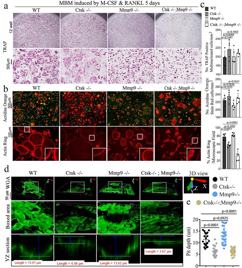 Knockout and Double Knockout of Cathepsin K and Mmp9 reveals a novel ...