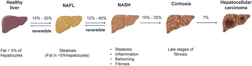 Mouse models of nonalcoholic fatty liver disease (NAFLD ...