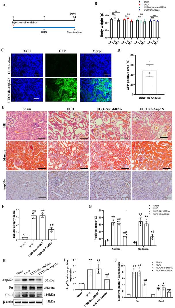 Anp32e promotes renal interstitial fibrosis by upregulating the ...
