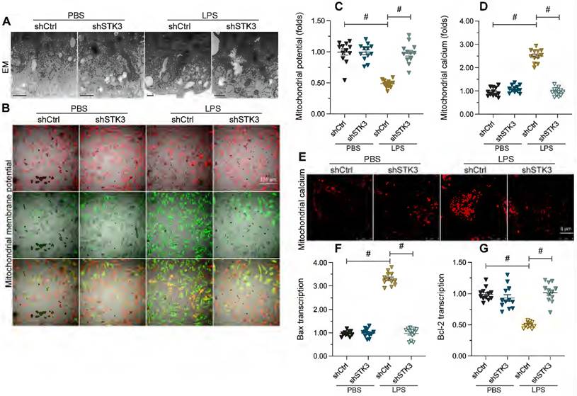 Serine/threonine kinase 3 promotes oxidative stress and mitochondrial ...