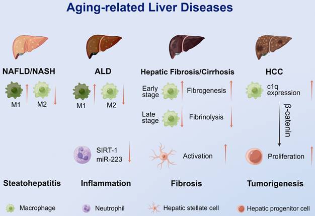 The Roles of Myeloid Cells in Aging-related Liver Diseases