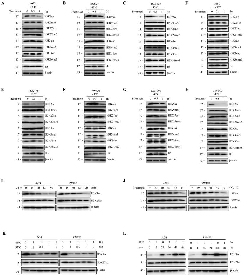 Inhibition of Heat Shock-Induced H3K9ac Reduction Sensitizes Cancer ...
