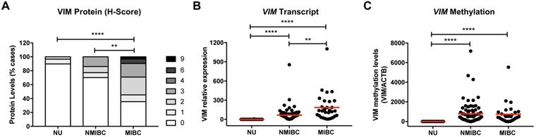 Vimentin epigenetic deregulation in Bladder Cancer associates with ...