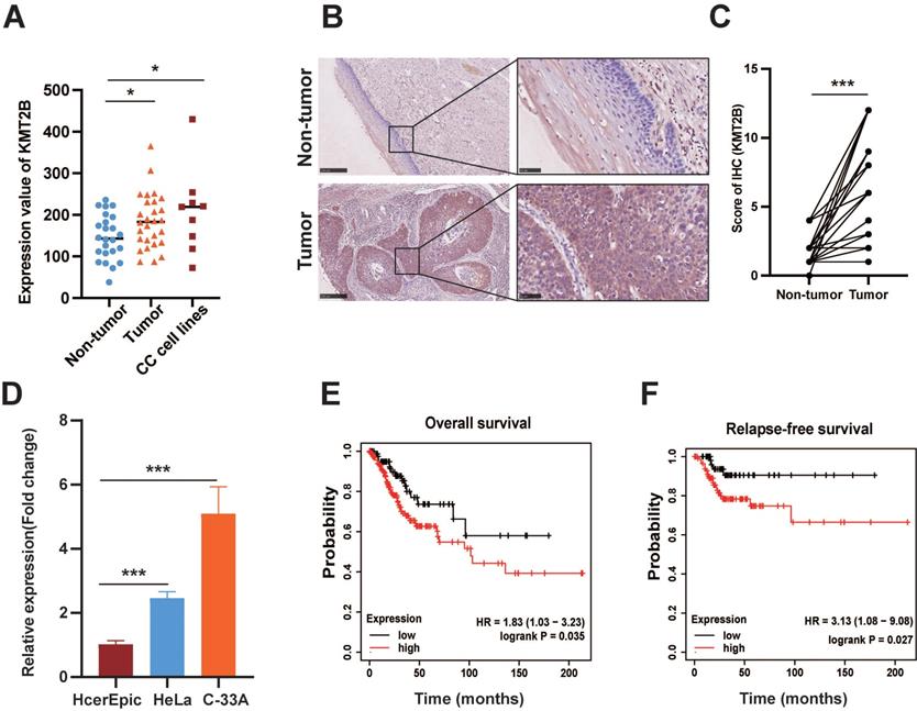 Histone Methyltransferase KMT2B Promotes Metastasis and Angiogenesis of ...