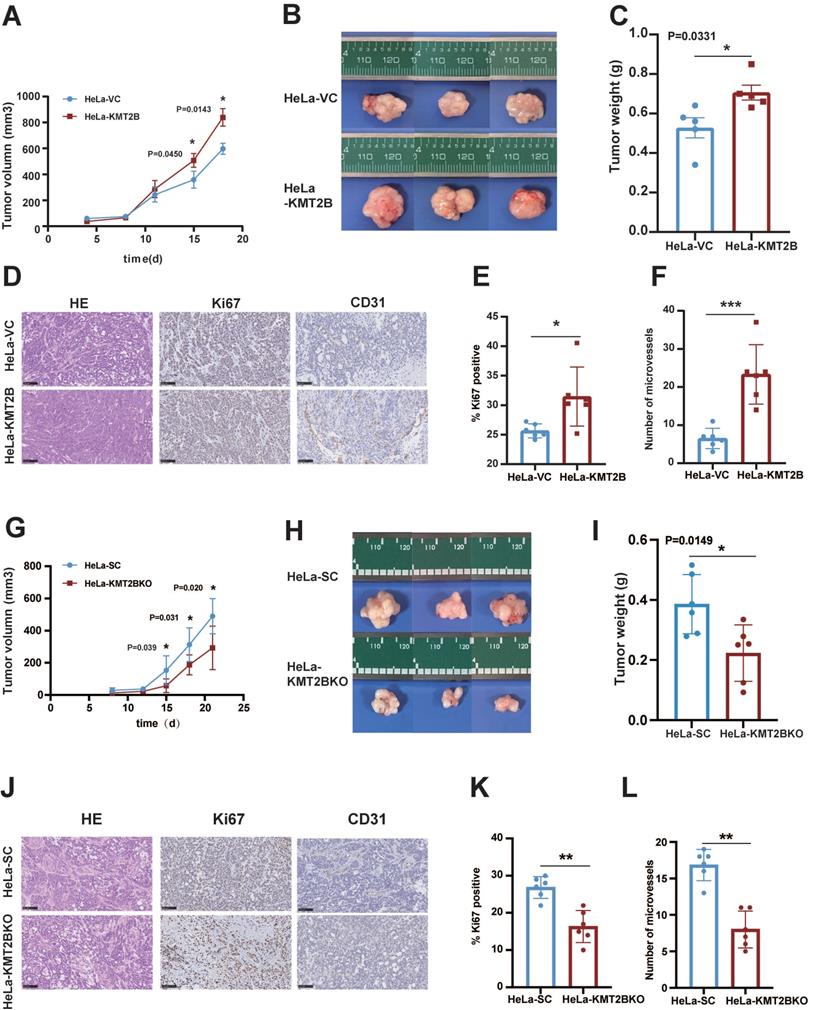 Histone Methyltransferase KMT2B Promotes Metastasis and Angiogenesis of ...
