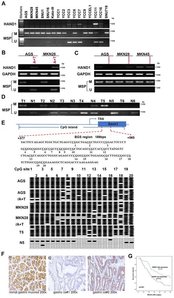 The developmental regulator HAND1 inhibits gastric carcinogenesis ...