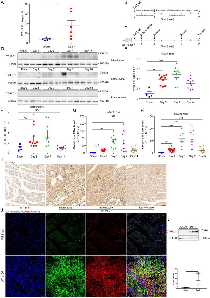Cthrc1 deficiency aggravates wound healing and promotes cardiac rupture ...