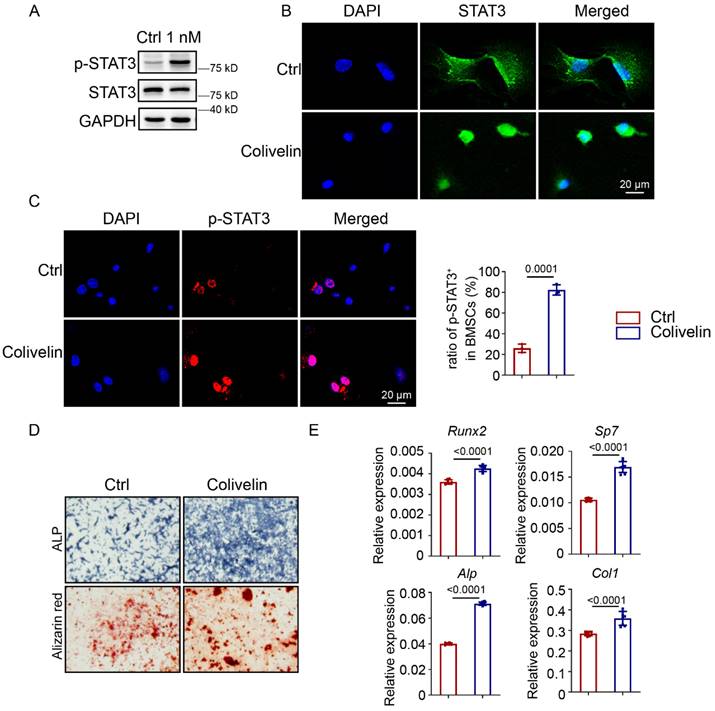 Exercise maintains bone homeostasis by promoting osteogenesis through STAT3