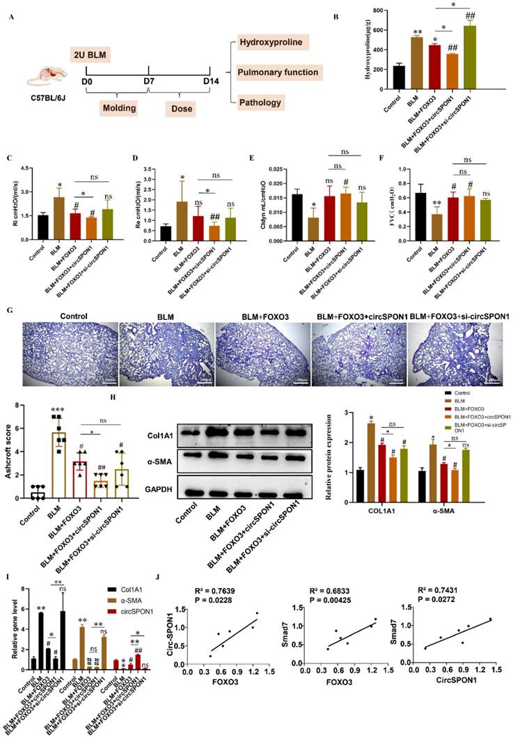 FOXO3 regulates Smad3 and Smad7 through SPON1 circular RNA to inhibit ...