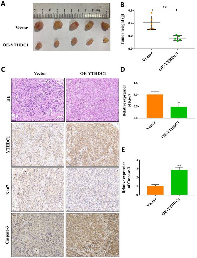 Low expression of m6A reader YTHDC1 promotes progression of ovarian ...
